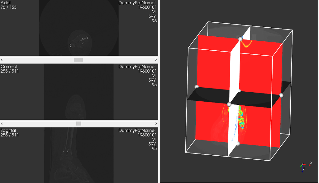 How to use vtkResliceCursorWidget ?? - Support - VTK