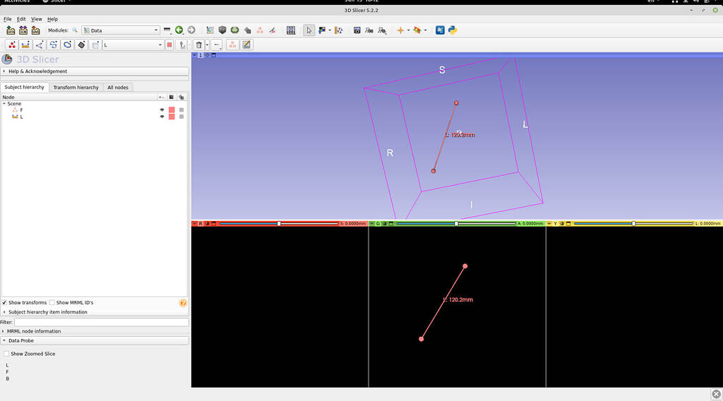 We assembled a widget from 3D Slicer in the browser - Development - VTK