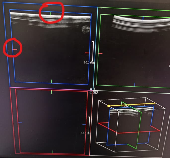 How To Draw Line On ImagePlanewidget Support VTK